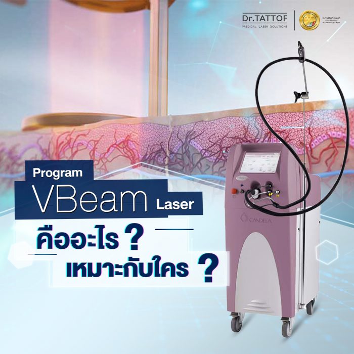 Program Vbeam Laser คืออะไร? เหมาะกับใคร? – Dr.TATTOF