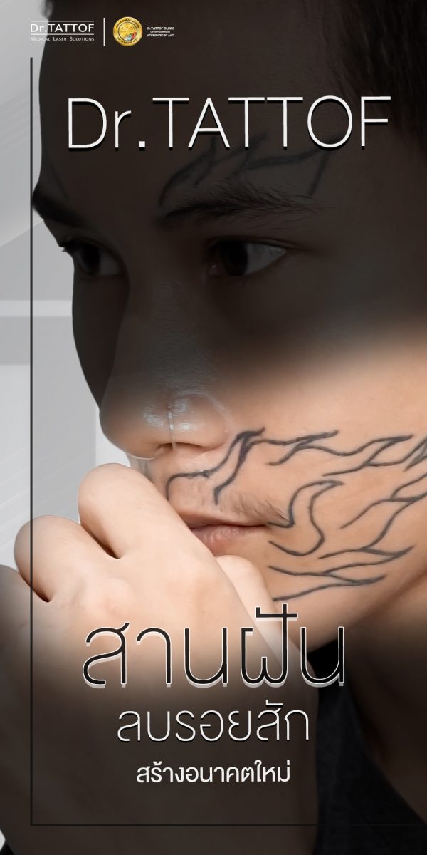 Dr.TATTOF สานฝัน “ลบรอยสัก” สร้างอนาคตใหม่ให้กับ “น้องภู” หนุ่มรอยสักใบหน้า – Dr.TATTOF